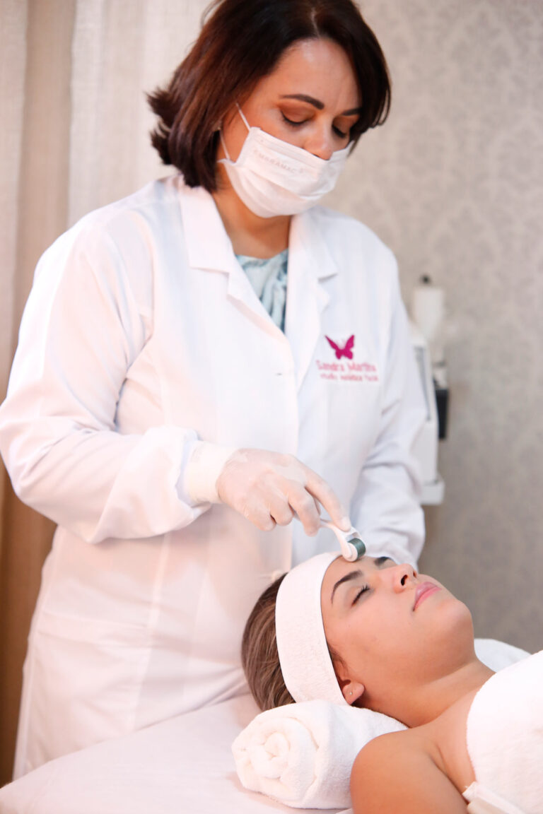 Microagulhamento e tipos de cicatriz de acne em Taguatinga - Sandra ...